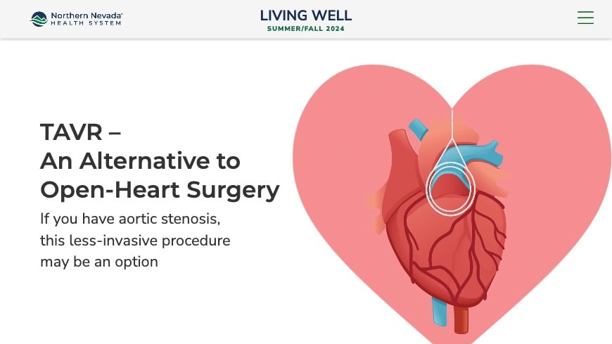 TAVR | Northern Nevada Health System, Sparks, Nevada